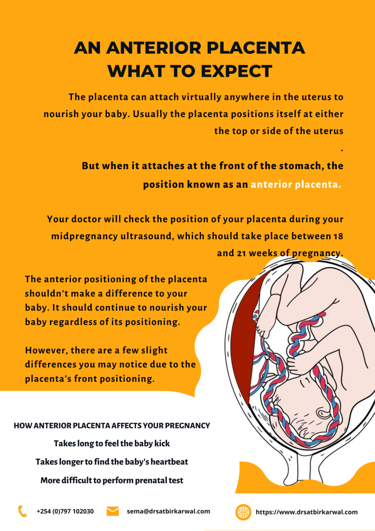 Anterior Placenta: What to expect - Dr Satbir Karwal